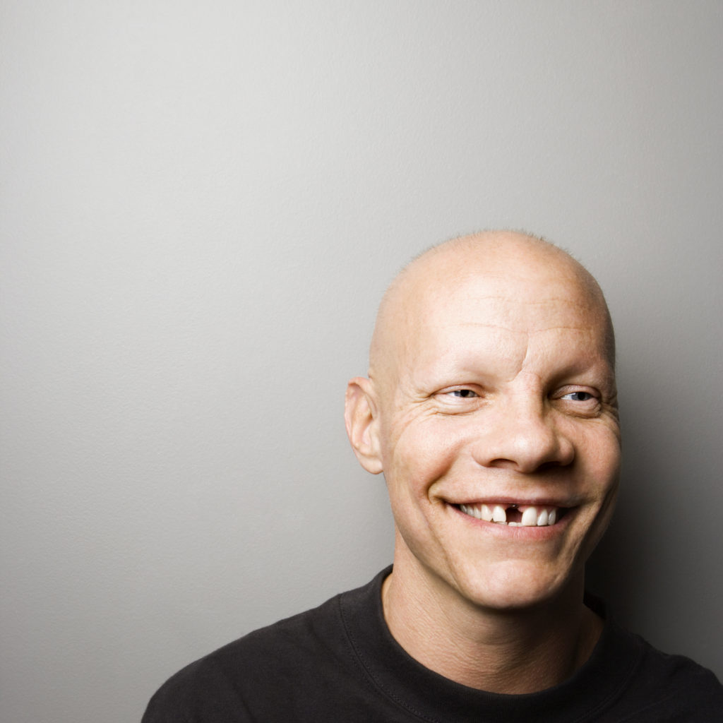 Options For Missing Teeth Replacement Teeth Visalia CA